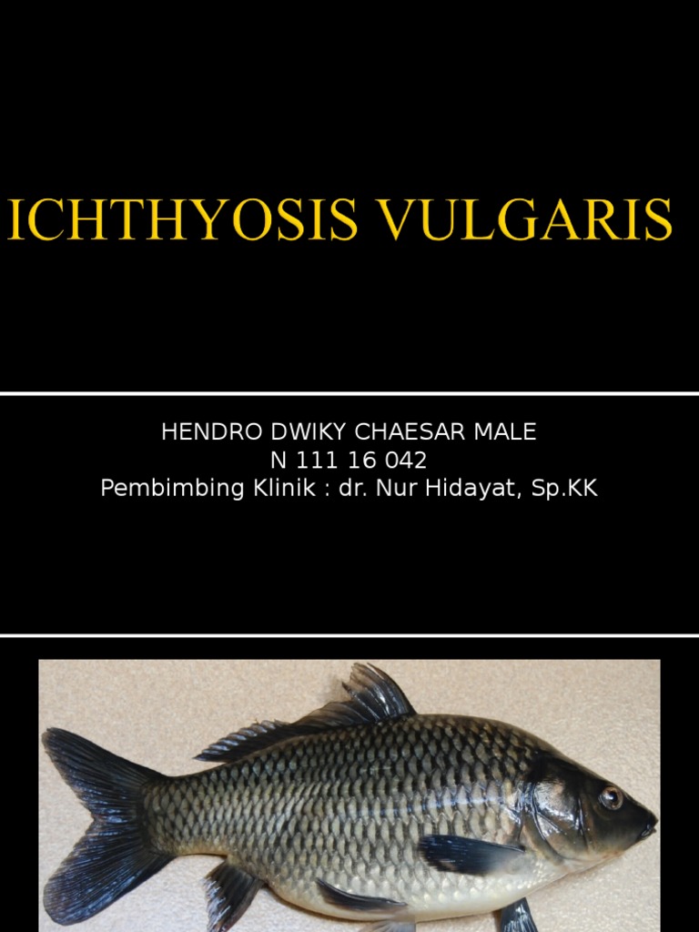 Ichthyosis Vulgaris | PDF