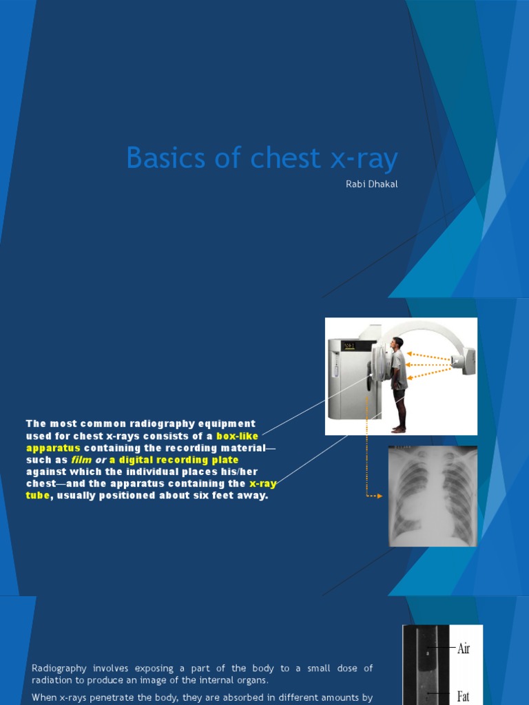 Basics of Chest X-Ray | PDF | Thorax | Lung