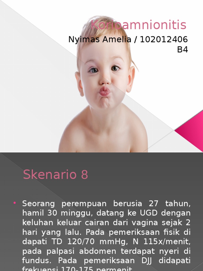 Korioamnionitis | PDF