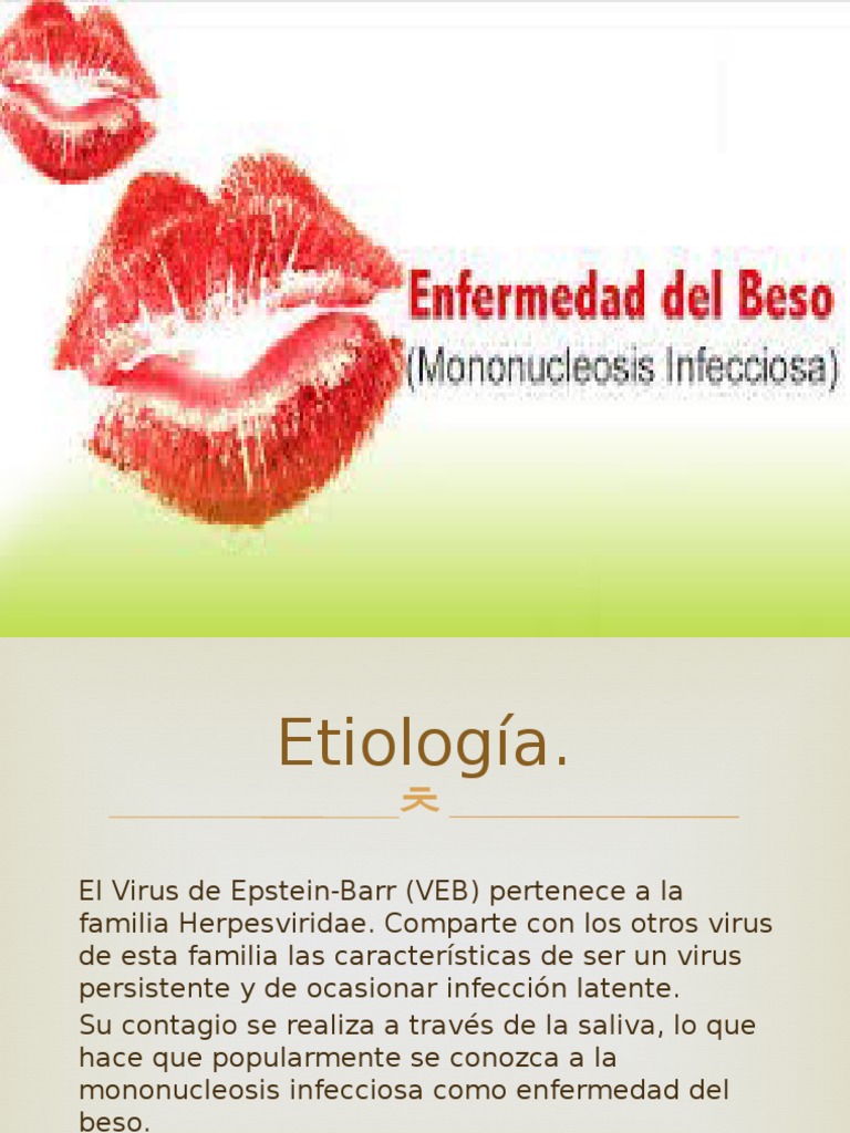 Mononucleosis Infecciosa | PDF | Epidemiología | Ciencias de la Salud