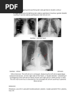 Interpretasi Vision-Test Jaeger | PDF | Visual Impairment | Visual Acuity