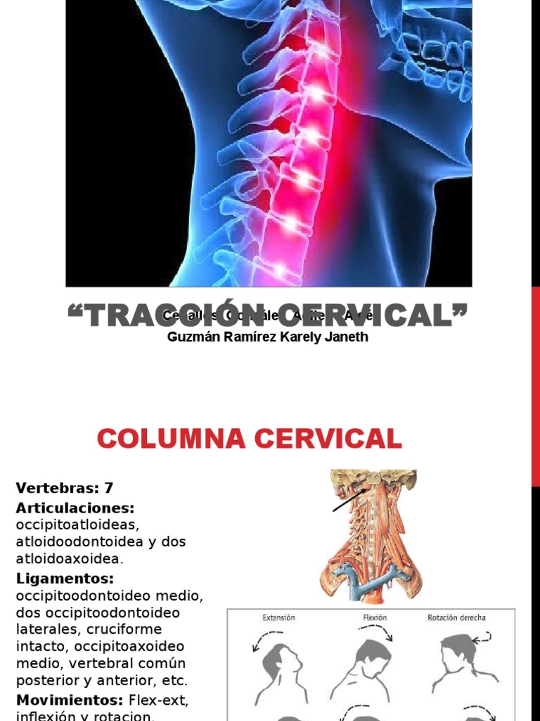 Tracción Cervical | PDF