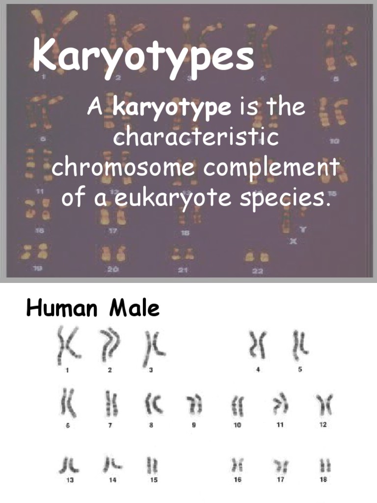 Karyotypes: A Karyotype Is The Characteristic Chromosome Complement of ...