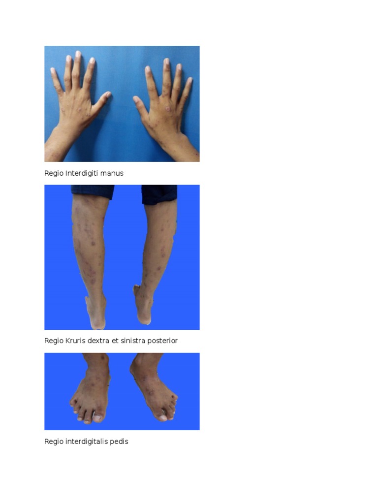 Regio Interdigiti Manus | PDF