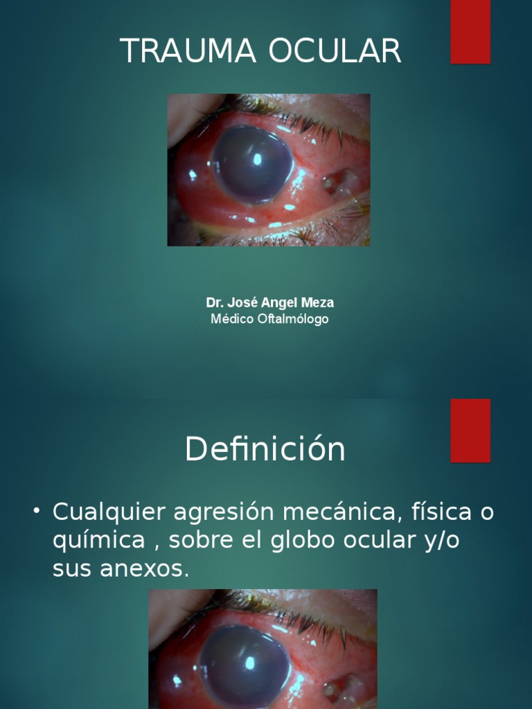 Trauma Ocular | Lesión | Ojo humano