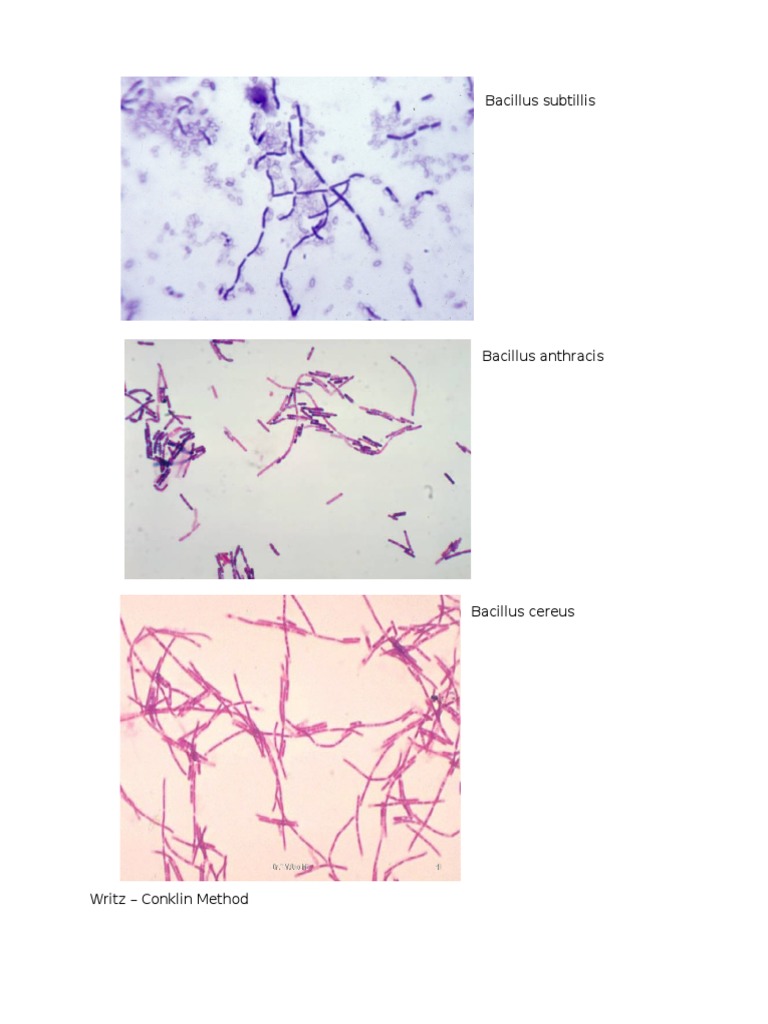 Bacillus SPP | PDF