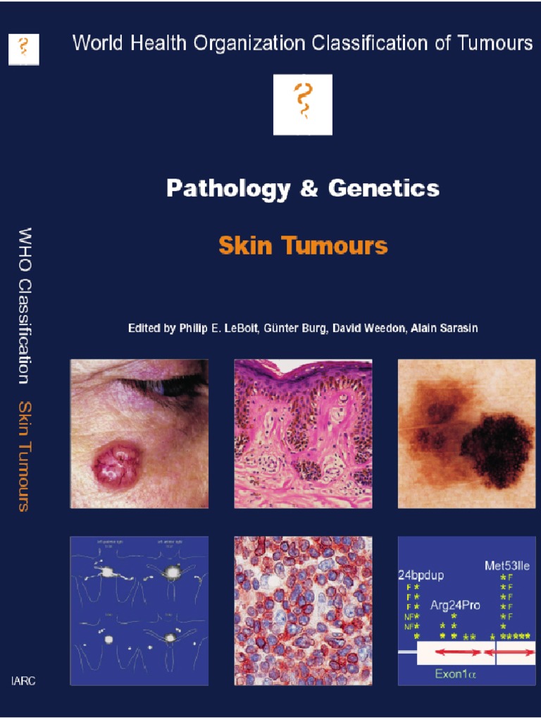 WHO - Pathology and Genetics of Skin Tumours | Carcinoma | Skin Cancer