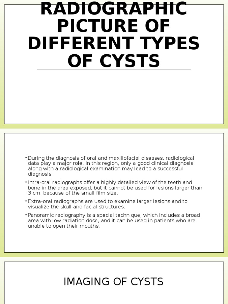 Cysts | PDF | Radiology | Mouth
