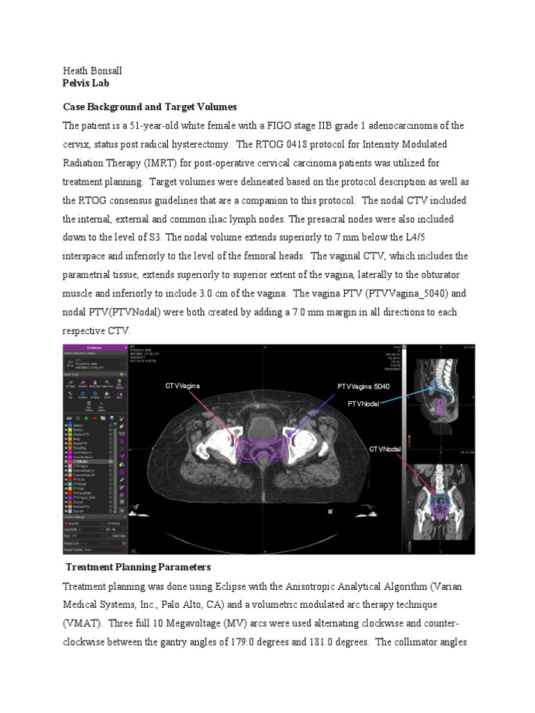 Pelvis Lab Case Background And Target Volumes Ctvvagina Pdf
