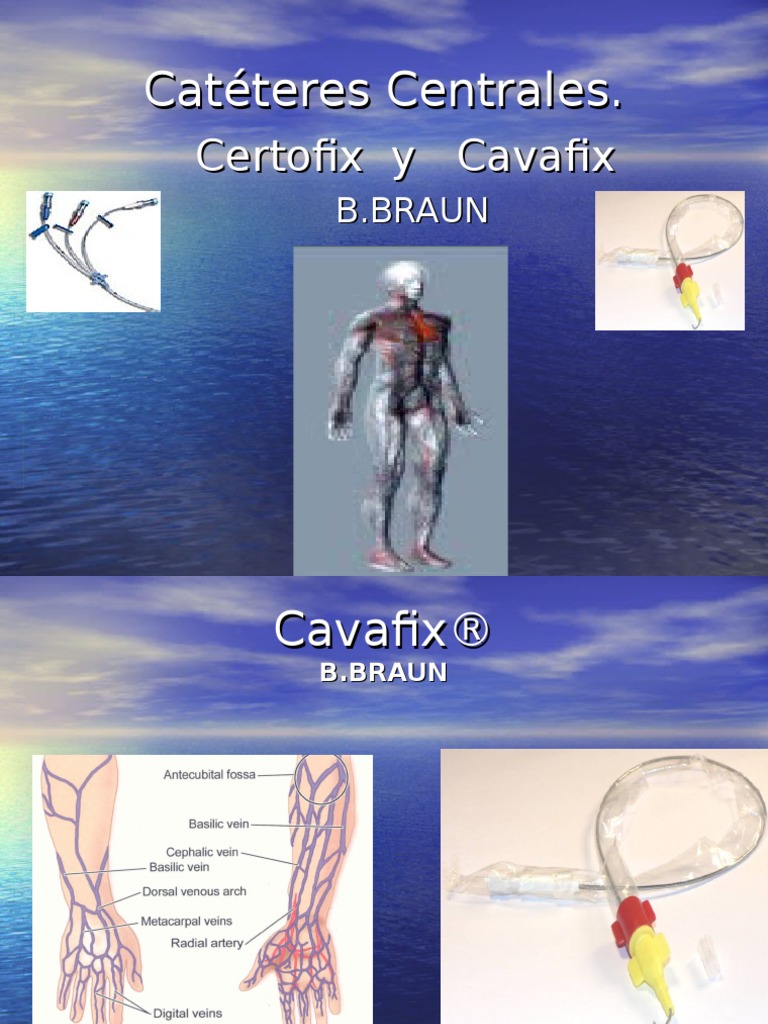 Cateteres Centrales | PDF | Vena | Especialidades Medicas