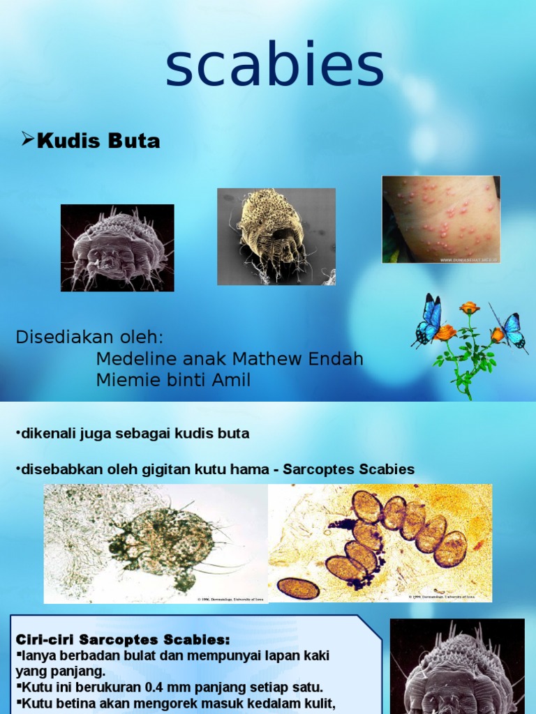 Scabies | PDF