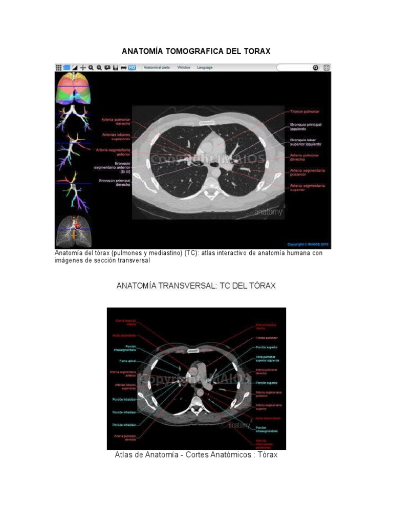 Anatomía Tomografica Del Torax