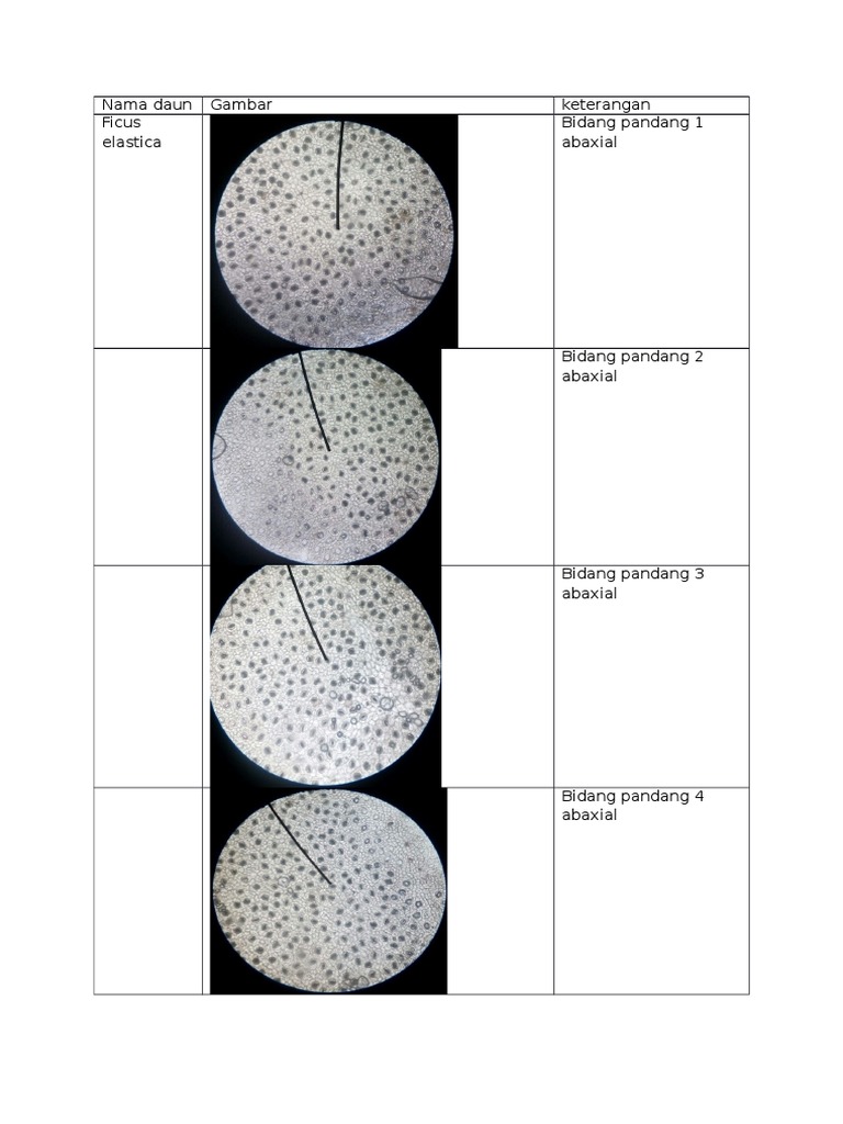 Struktur Daun Ficus Elastica Mikroskopis | PDF