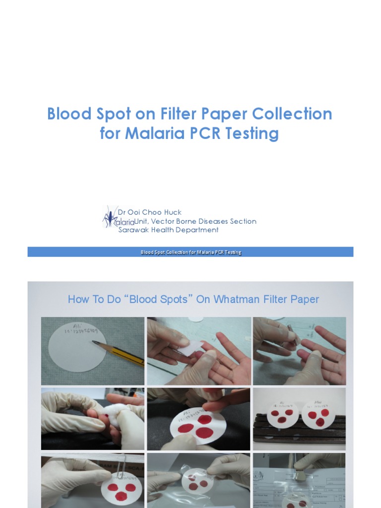 Proper Collection of Blood Spots on Filter Paper for Malaria PCR ...