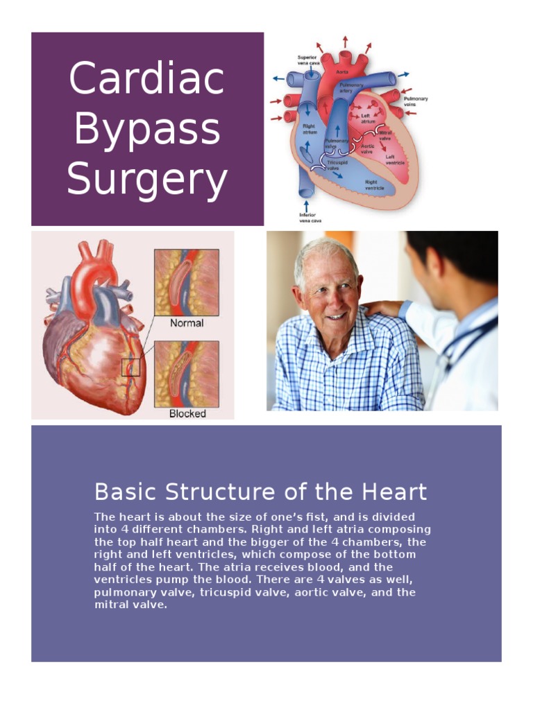 Cardiac Bypass Surgery Overview | PDF
