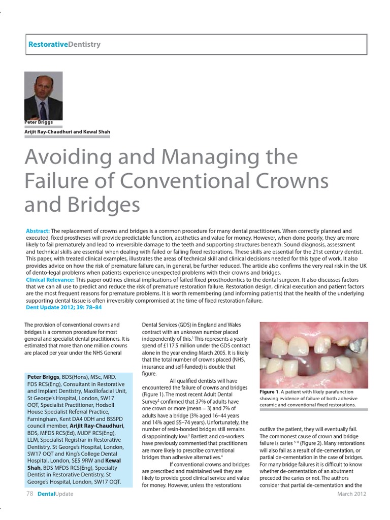 Avoiding and Managing The Failure of Conventional Crowns and Bridges ...