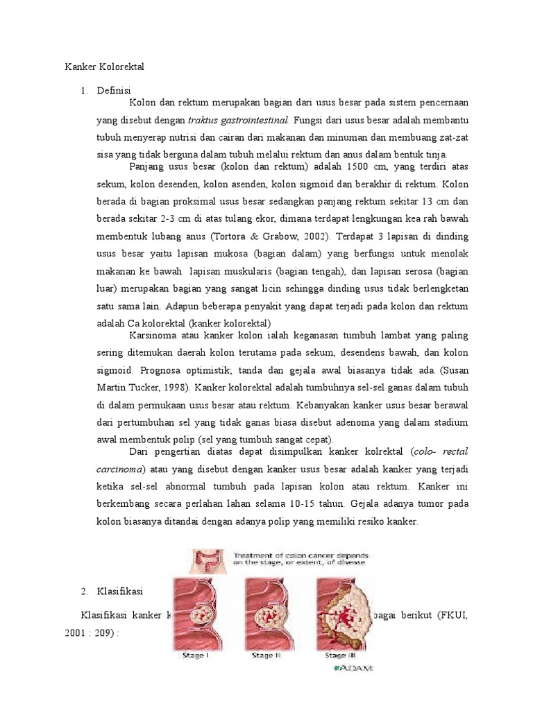 Kanker Kolorektal