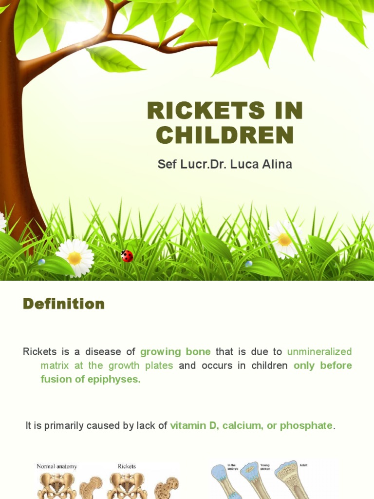 Rickets in Children | Download Free PDF | Vitamin D | Wellness