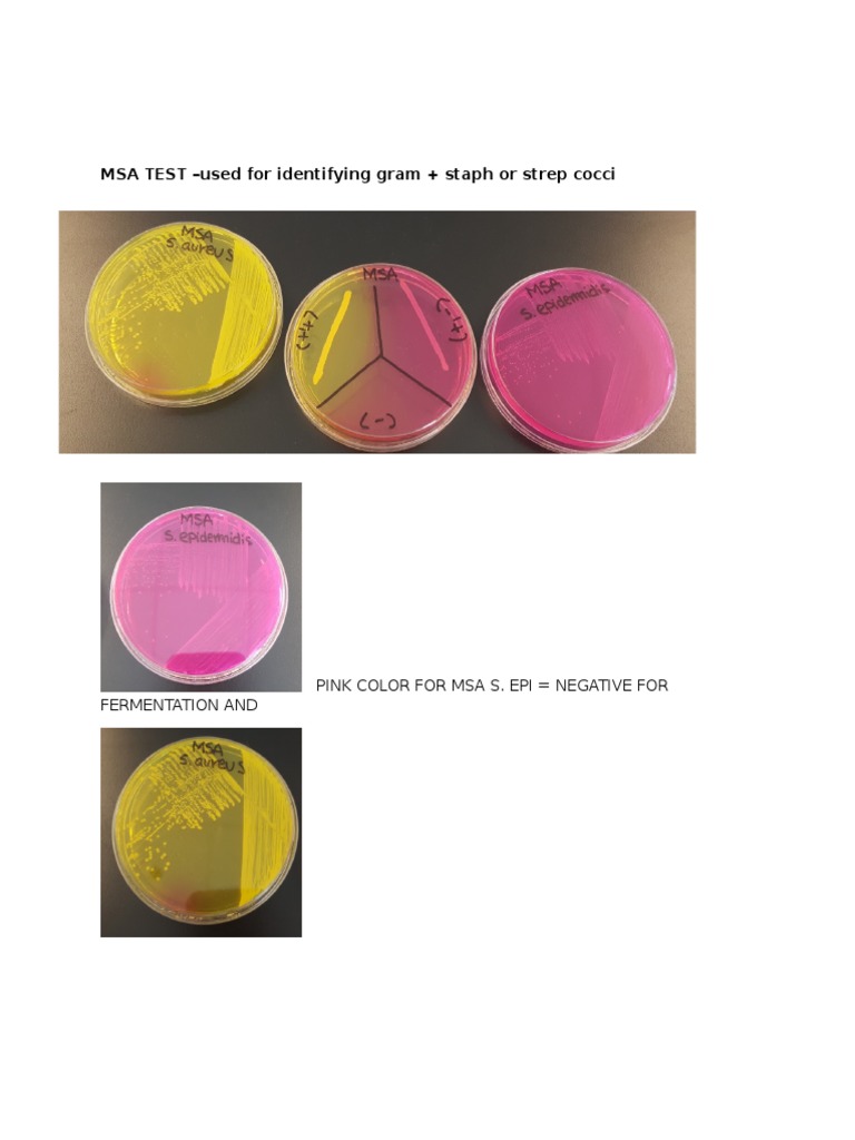 MSA TEST - Used For Identifying Gram + Staph or Strep Cocci: Pink Color ...