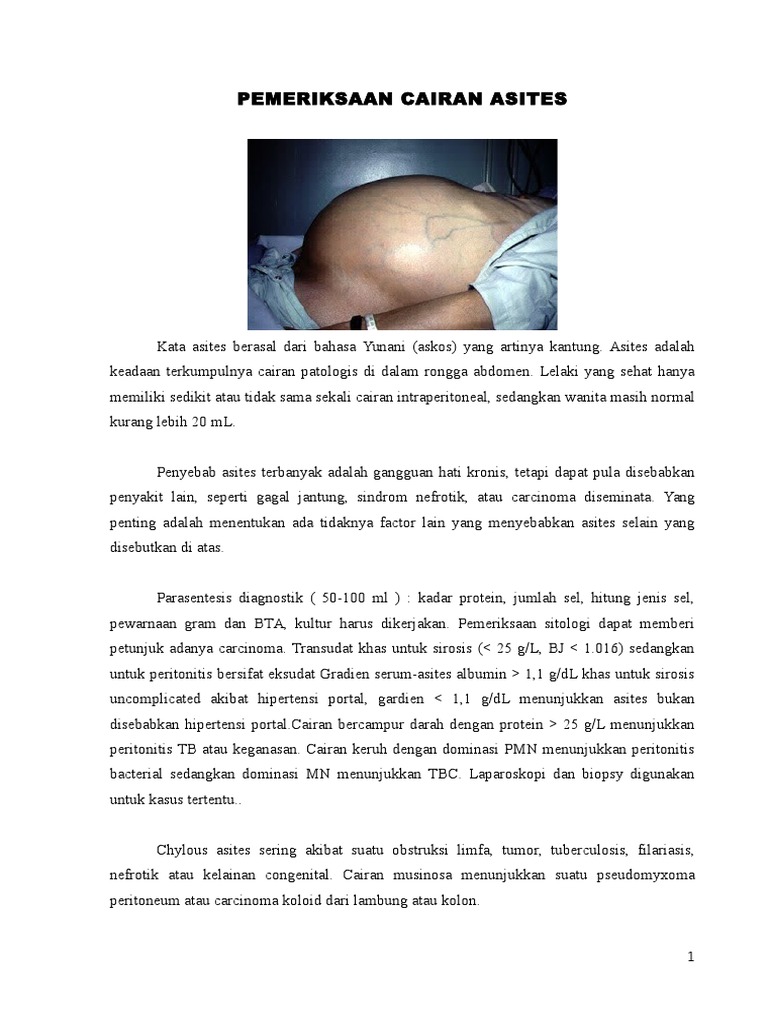 PEMERIKSAAN CAIRAN ASITES