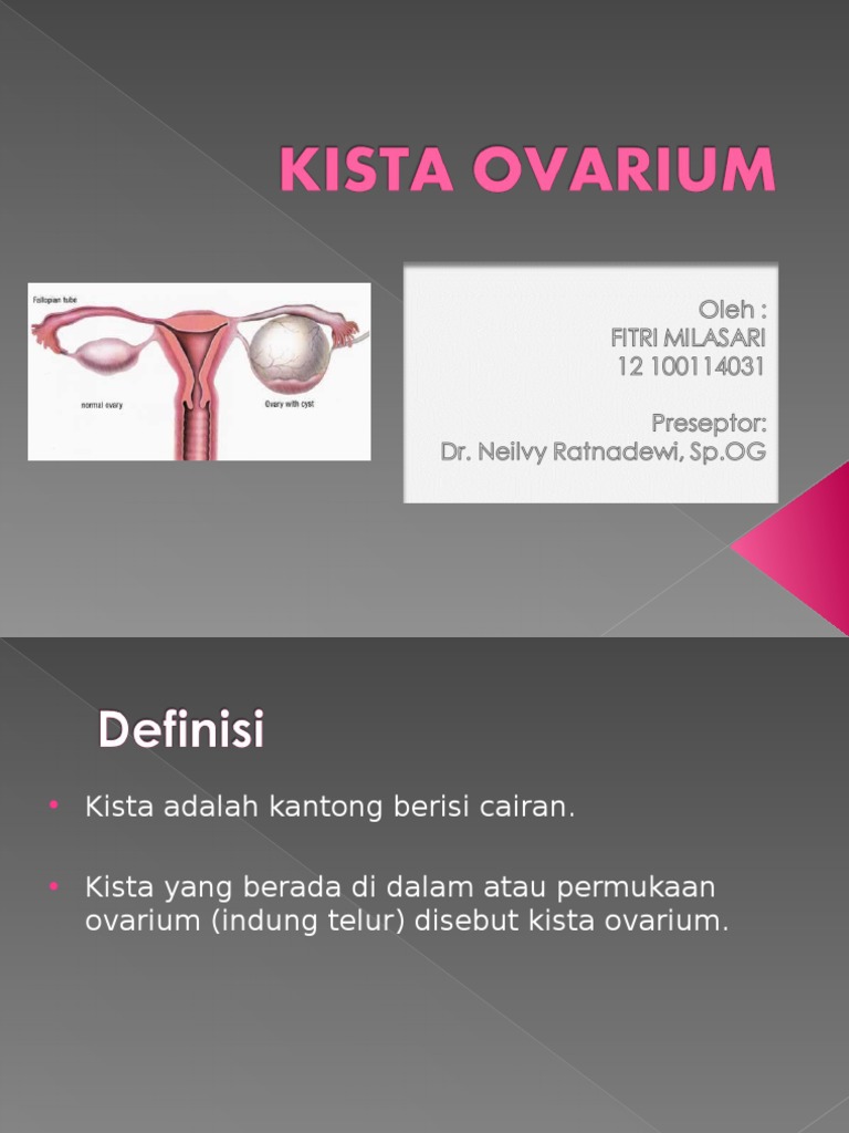 CSS Kista Ovarium | PDF