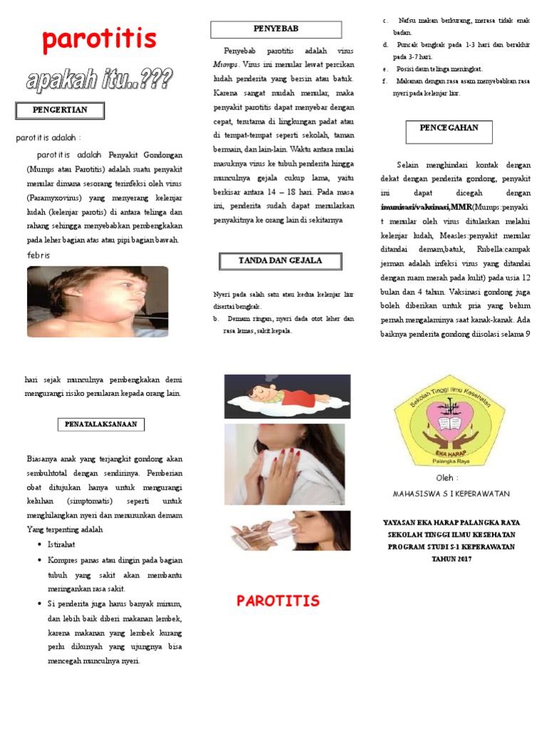 Gejala dan Penanganan Parotitis Anak | PDF