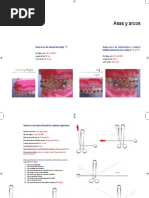 Tipping y Torque en Ortodoncia | PDF | Especialidades Medicas | Ramas ...