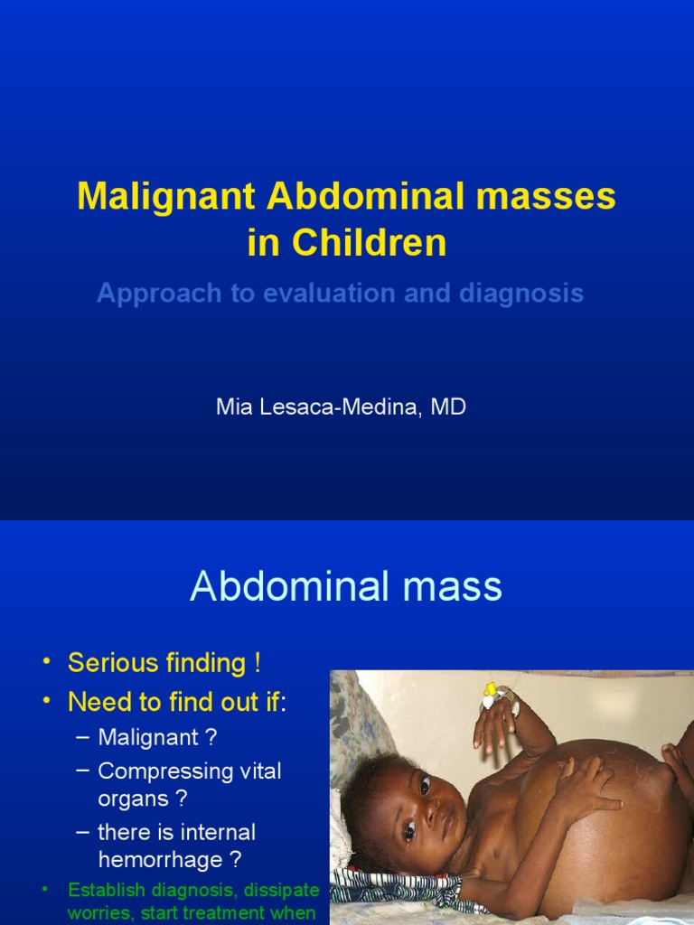 Approach To Abdominal Masses in Children | PDF | Cancer | Teaching ...