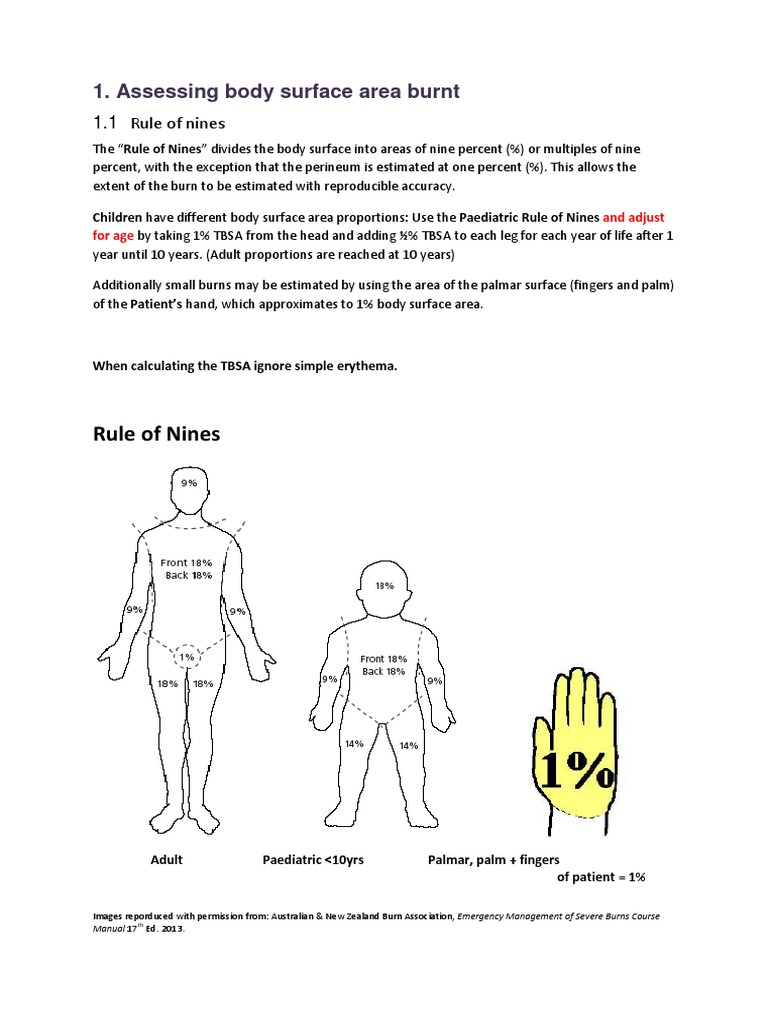 Burns Rule of Nines 2013 | PDF