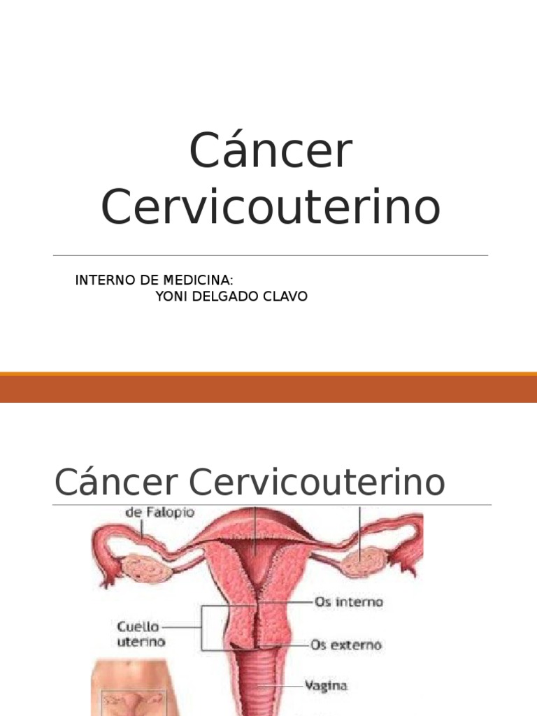 Estadificación del Cáncer Cervicouterino | PDF | Cáncer de cuello ...