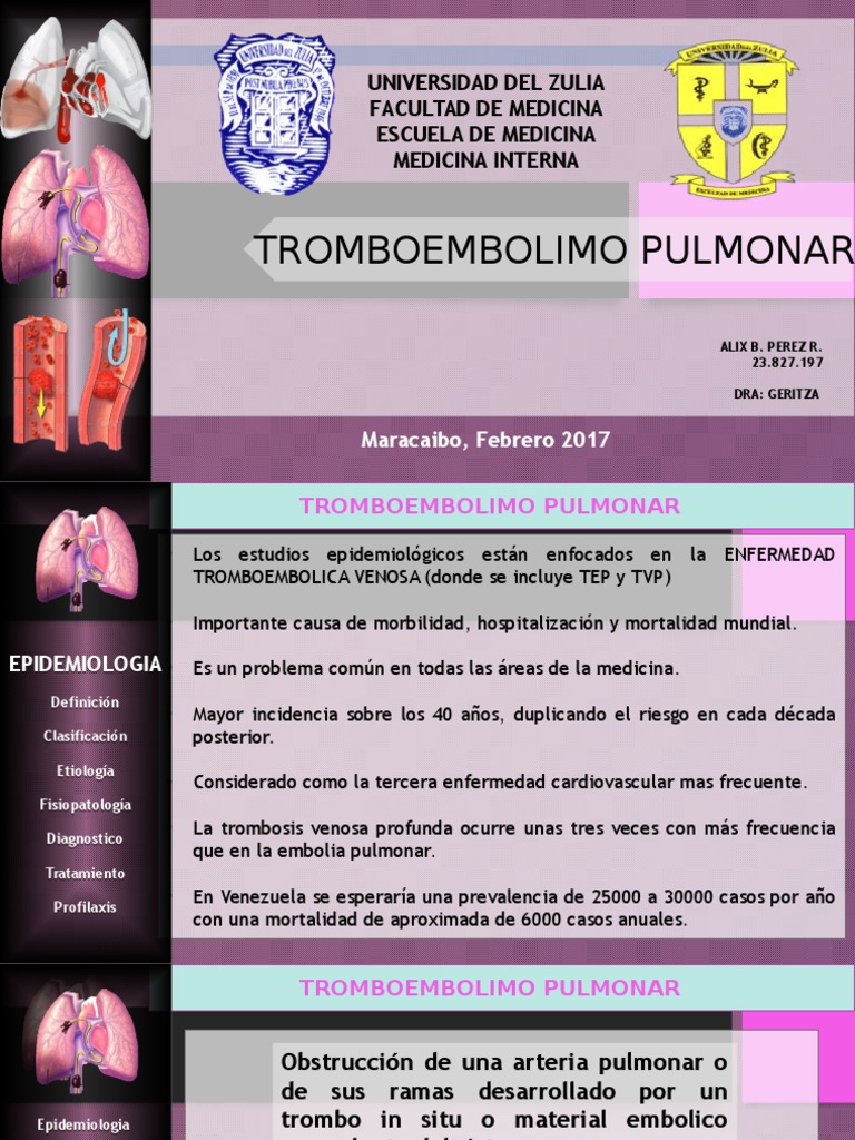 TROMBOEMBOLISMO PULMONAR | Embolia | Trombo
