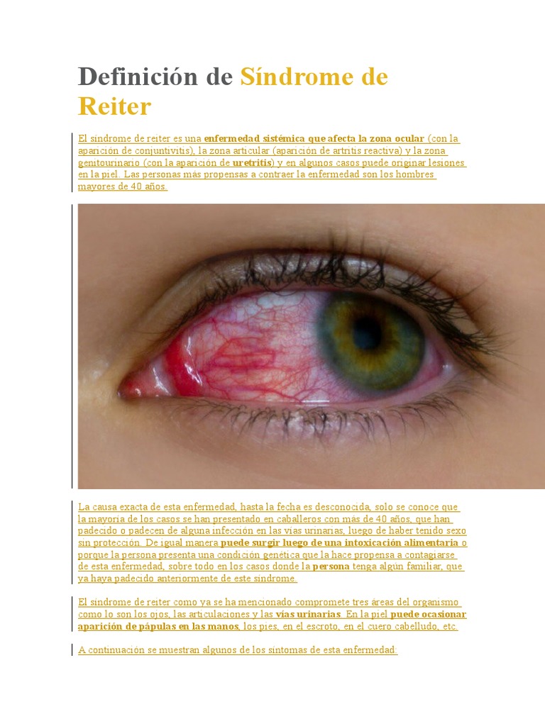Sindrome de Reiter | PDF | Especialidades Medicas | Medicina CLINICA