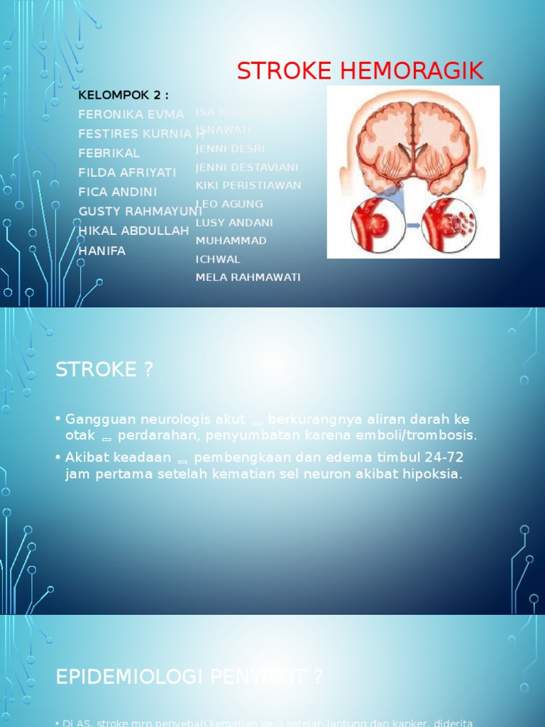 Stroke Hemoragik | PDF