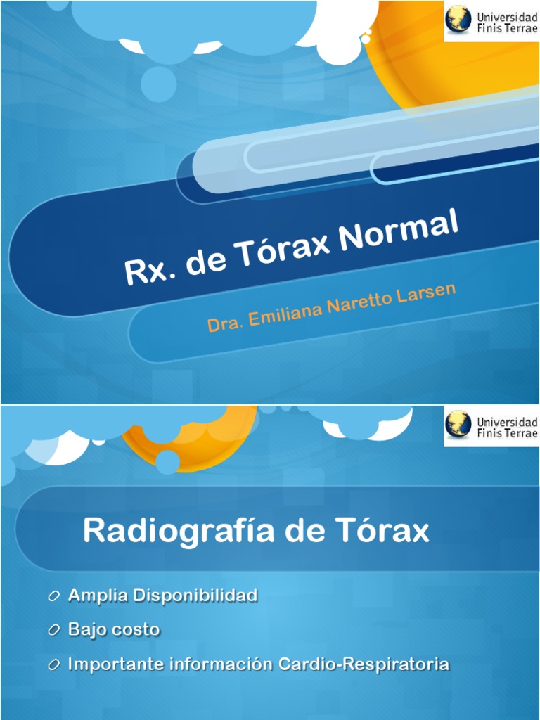 RX TX Normal | PDF | Aorta | Pulmón