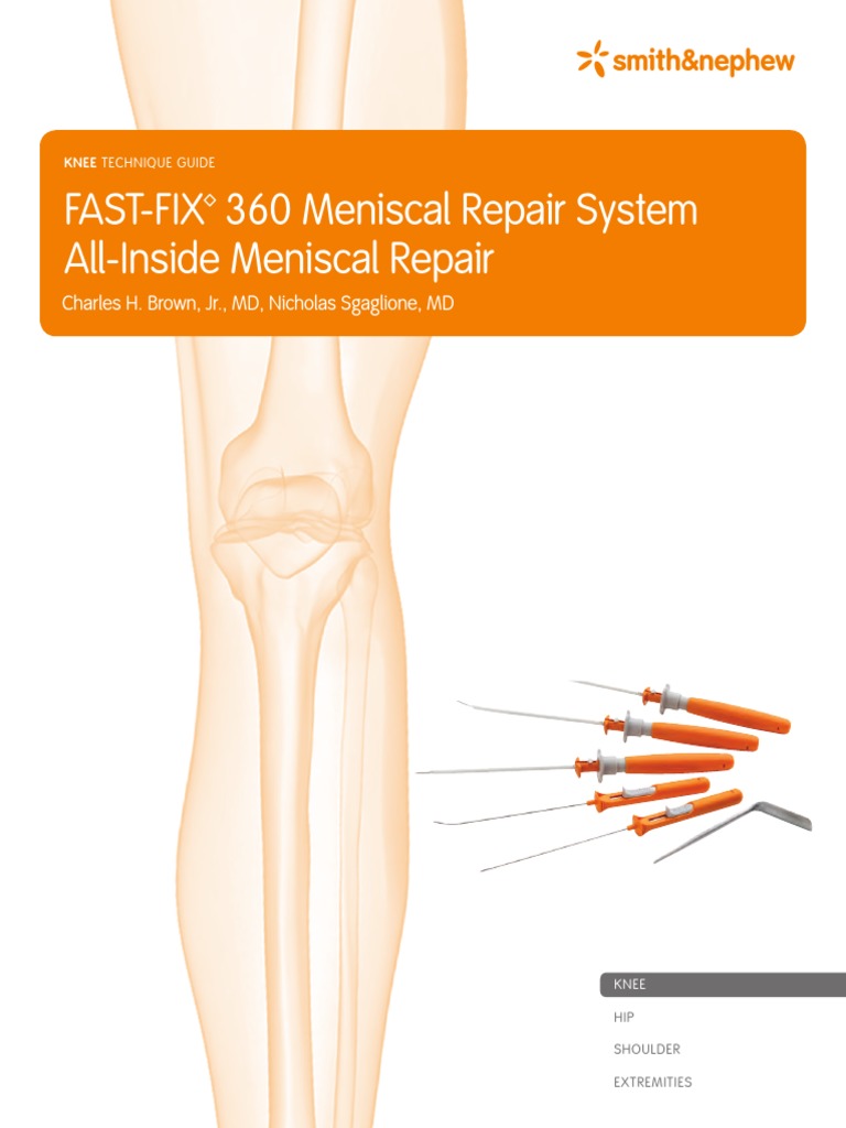 Smith & Nephew Fast-fix 360 Curved | Surgical Suture | Knee | Free 30-day Trial | Scribd