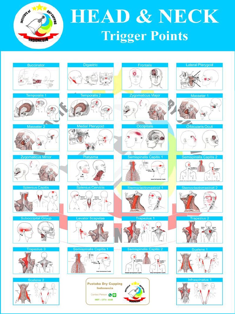 Bonus - Trigger Points Chart | PDF | Soft Tissue | Musculoskeletal System
