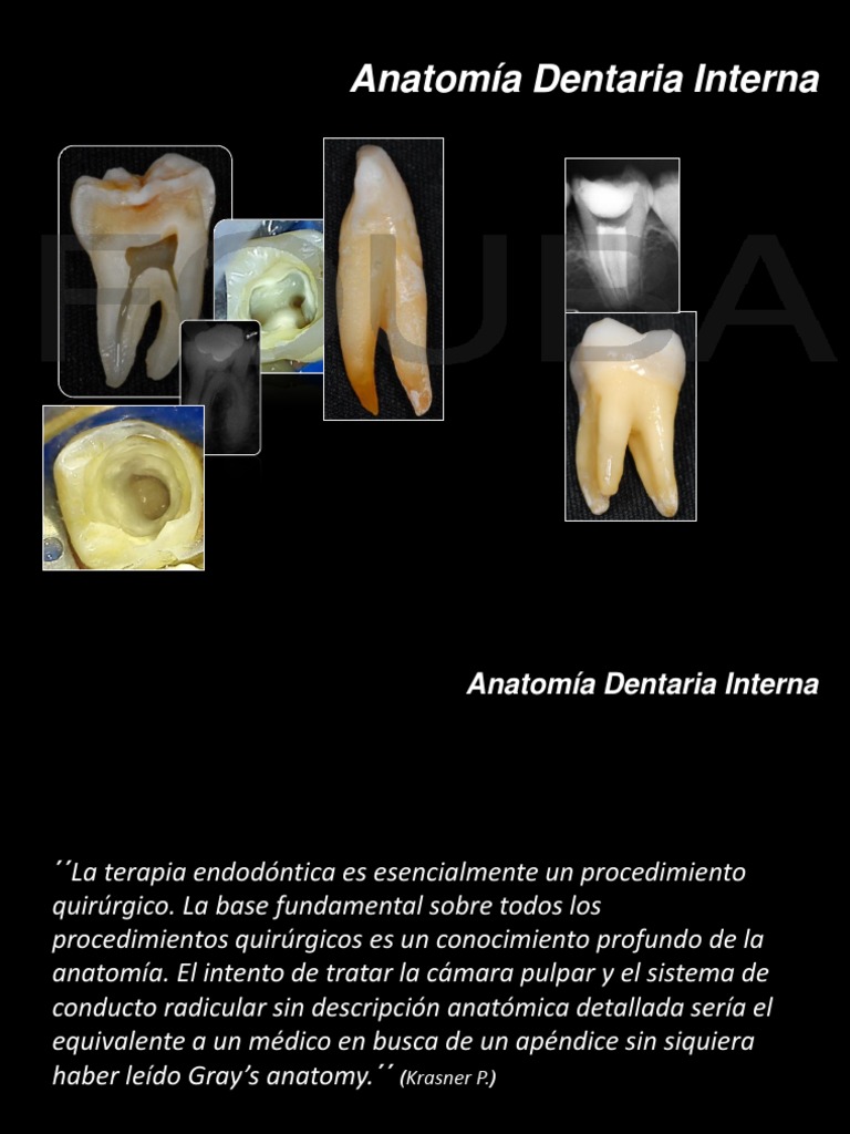 Anatomia de La Camara Pulpar PDF | PDF | Diente humano | Odontología