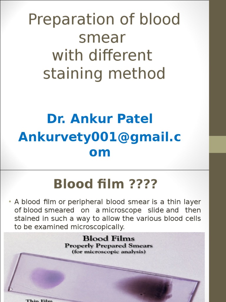 Preparation of Blood Smear With Different Staining Method: Dr. Ankur ...