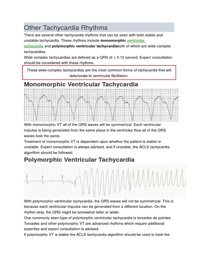 Other Tachycardia Rhythms | PDF
