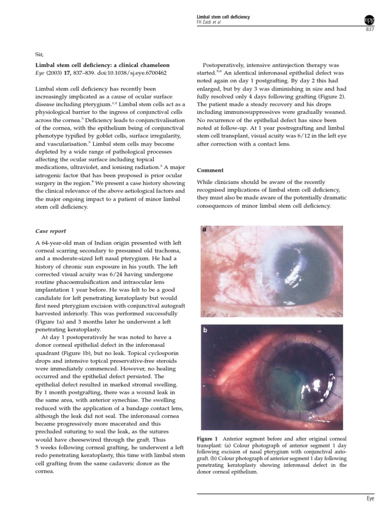Limbal Stem Cells | PDF | Cornea | Medical Specialties