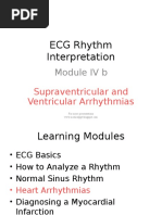 10 Common EKG Heart Rhythms PDF | PDF