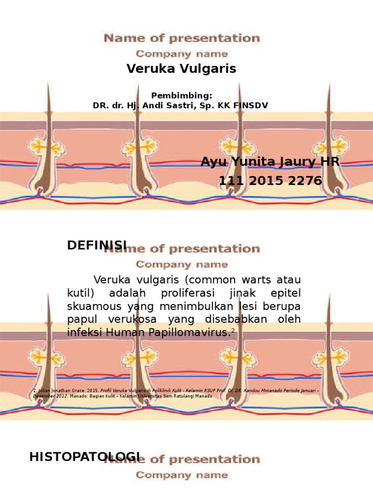 Veruka Vulgaris | PDF