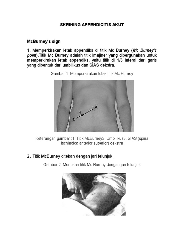 Pemeriksaan Fisik Appendicitis Akut | PDF