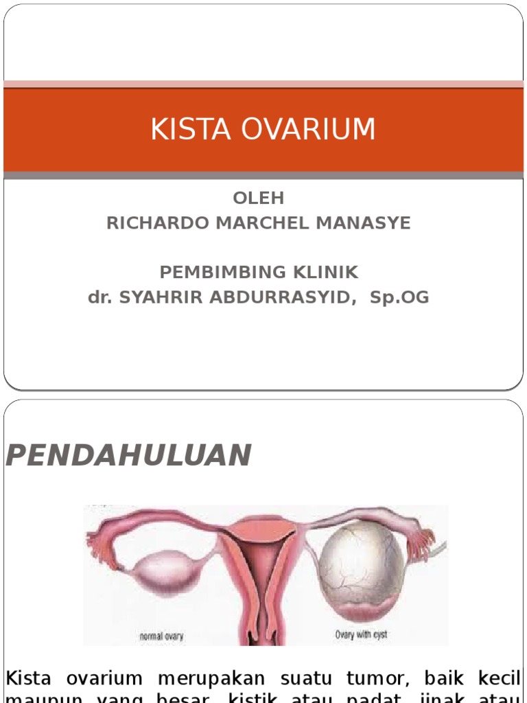 Kista Ovarium | PDF