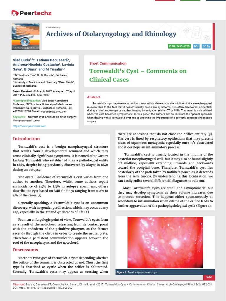 Tornwaldt’s Cyst – Comments on Clinical Cases | Endoscopy | Magnetic ...