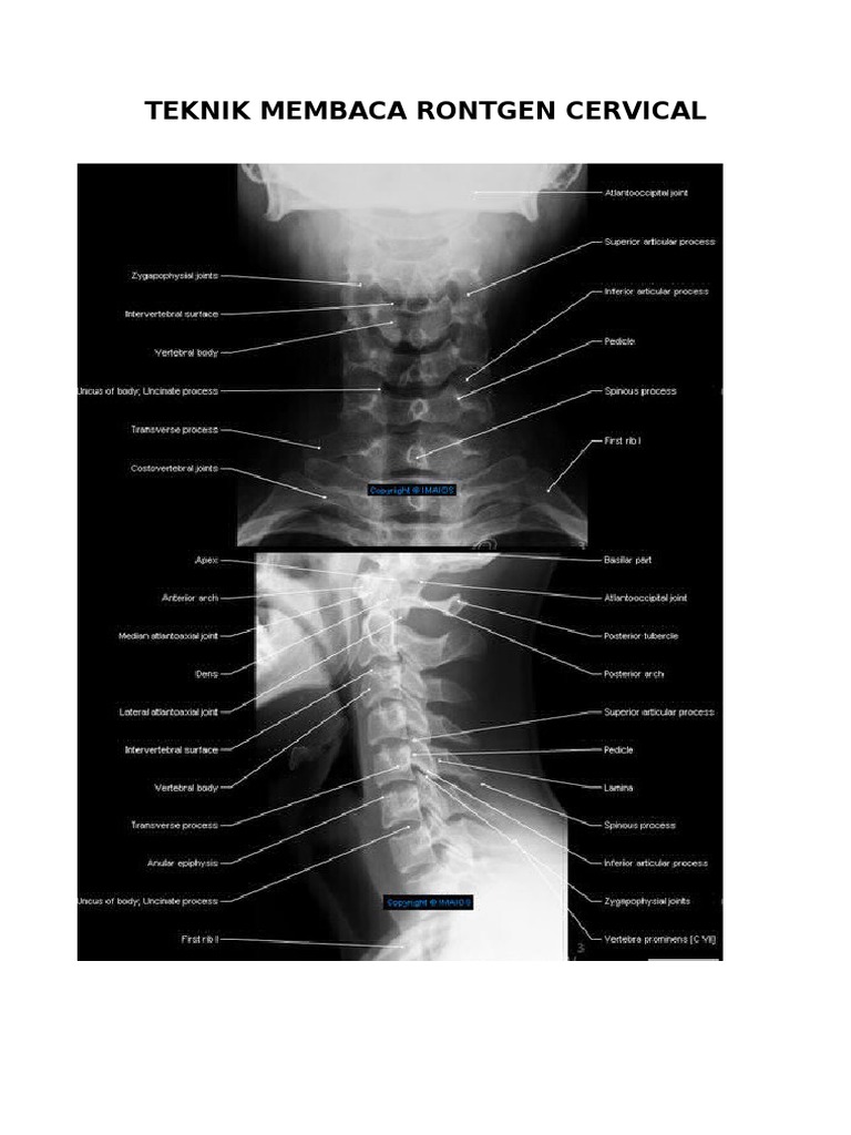Teknik Membaca Rontgen Cervical | PDF