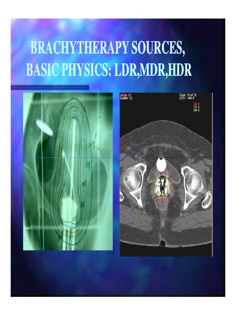 Brachy Sources Dr. Deshpande | PDF | Teaching Methods & Materials ...