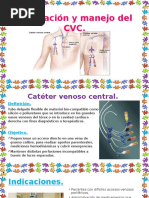 Catéter Mahurkar | PDF | Hemodiálisis | Especialidades Medicas