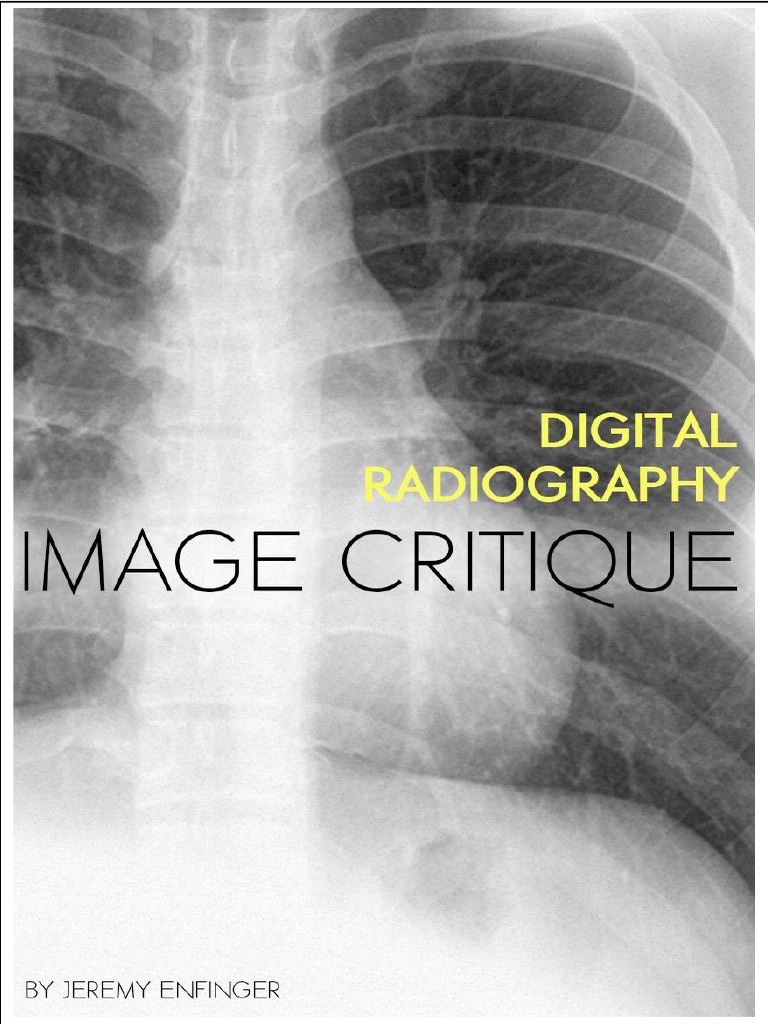 Digital Radiography Image Critique | Exposure (Photography) | Radiology