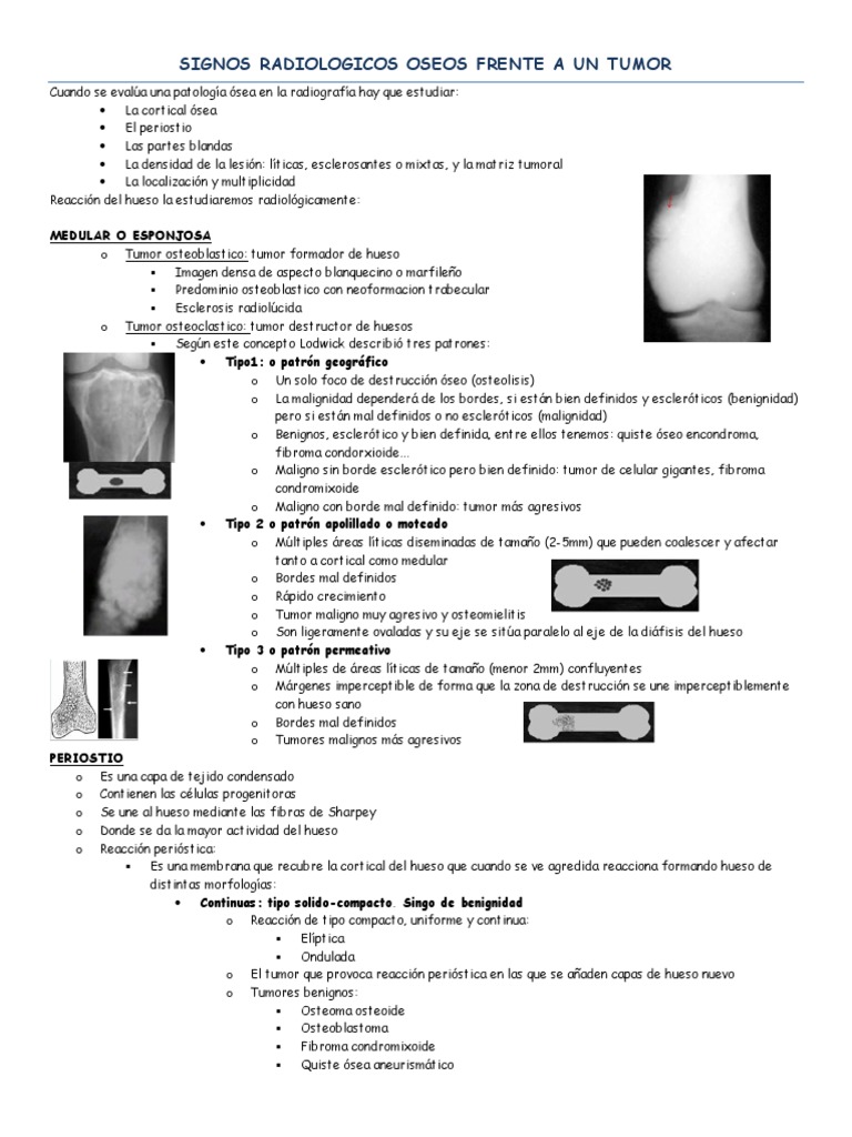 Signos Radiologicos Oseos en Tumoresb | PDF | Hueso | Cáncer